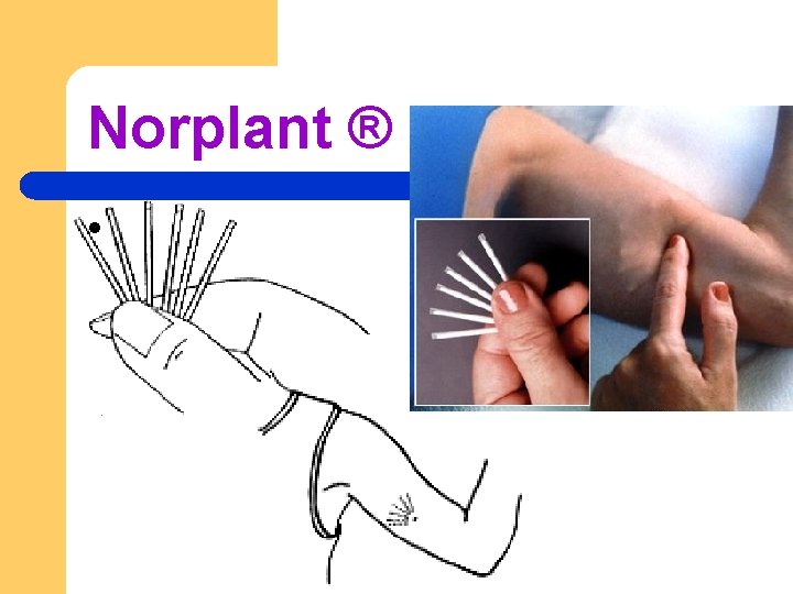 Reasons people have unplanned pregnancies Keys to pregnancy