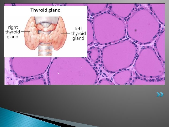 Thyroid gland pathology By Dr Mays Ibraheem Pathology