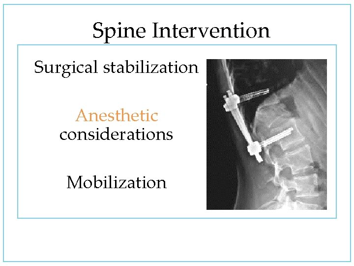 Oh My Broken Back Essentials of Spine Trauma