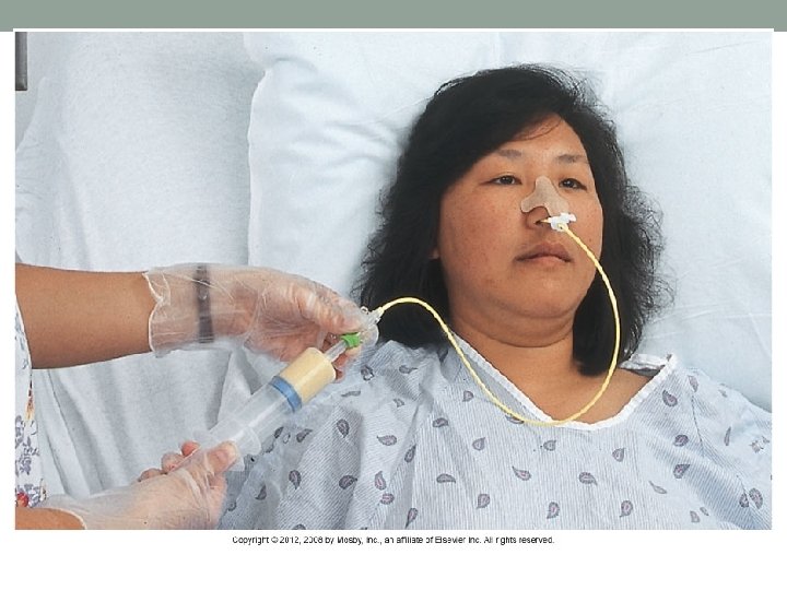 NASOGASTRIC TUBES INSERTION CARE AND REMOVAL Mrs April