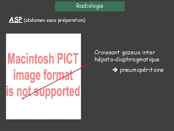 EXAMEN CLINIQUE DE LABDOMEN PRINCIPAUX SYNDROMES SEMIOLOGIE CHIRURGICALE