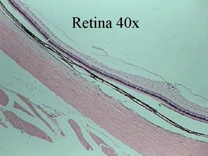 Lab 11 THE SPECIAL SENSES AND THE ENDOCRINE