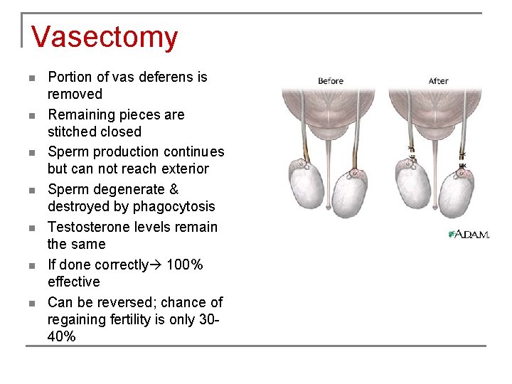 Male reproductive system n Gonads testes q n