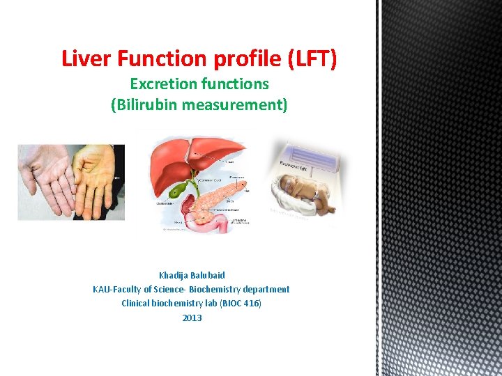 Liver Function profile LFT Excretion functions Bilirubin measurement
