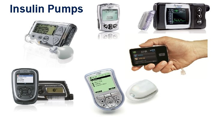 Updates in Type 1 Diabetes Rodica Busui MD