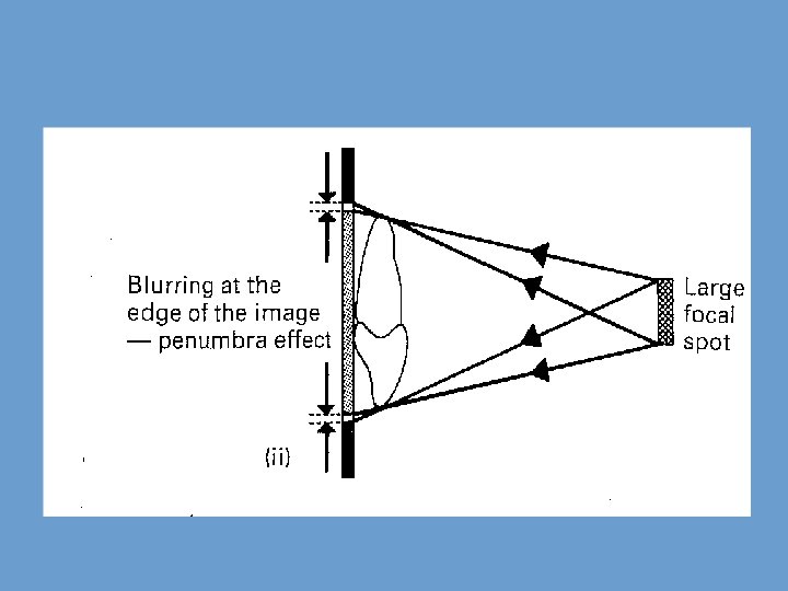 Factors affecting the radiographic image and film faults