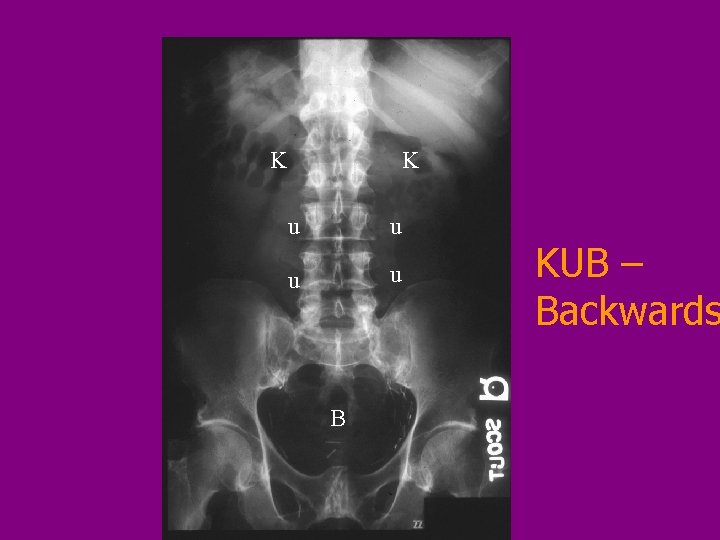 BASIC GI RADIOLOGY THE FLAT PLATE Michael Maristany