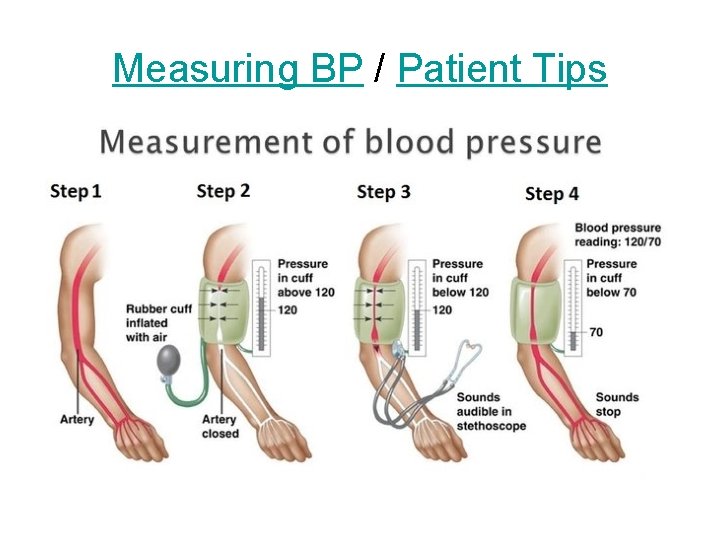 The Vascular System Bellringer What allows you to