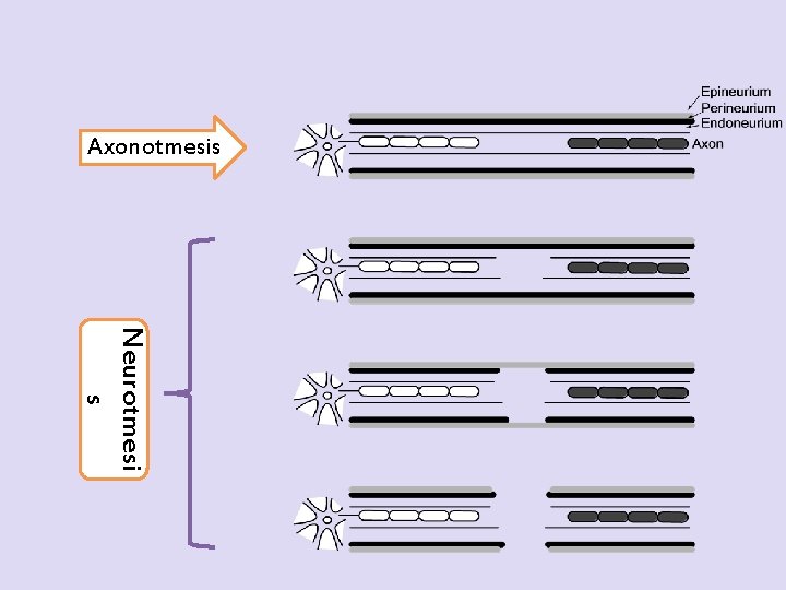 Facial nerve Anatomy Intracranial Intratemporal Intrameatal Labyrinthin ...
