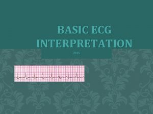 How to Interpret an ECG Chapter 22 ECG
