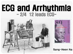 How to Interpret an ECG Chapter 22 ECG