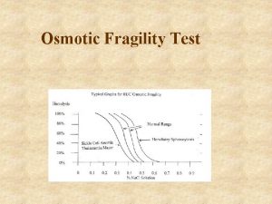 Osmotic Fragility Test Osmotic fragility Definition Osmotic fragility