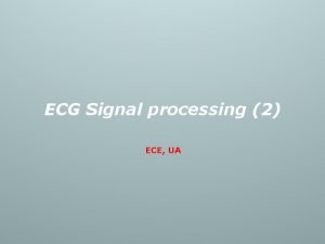 ECG Signal processing 2 ECE UA ECG signal